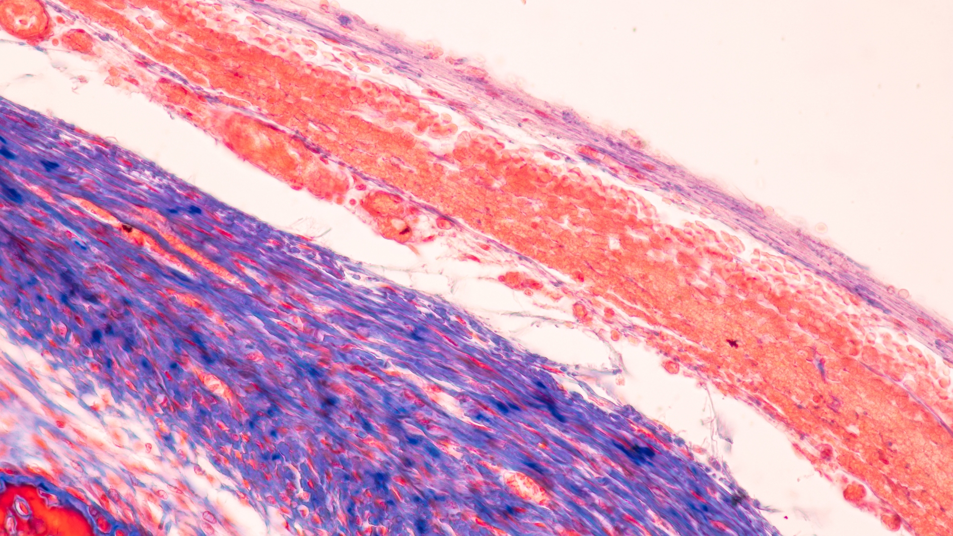 The Importance of Tissue Oxygenation in Recovery - LiveO2